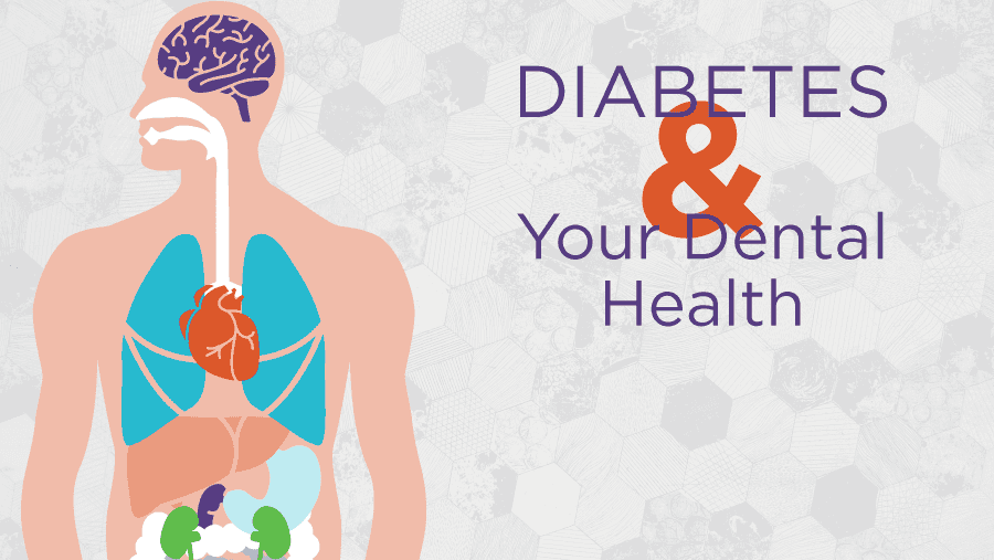 The Sweet Tooth: Diabetes and Your Oral Health | General Dentistry ...